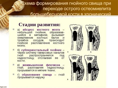 Большеберцовая и малоберцовая кость анатомия расположение патологии