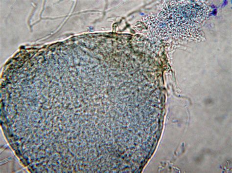 Coelomycetes Mycology University Of Adelaide