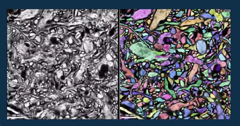 E11 Bio Introduces Prism Revolutionizing Brain Connectomics For