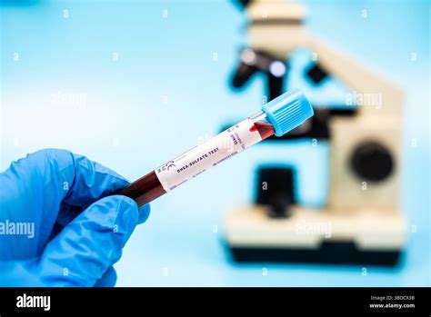 Dehydroepiandrosterone Sulphate Test Measures Dehydroepiandrosterone Dhea Sulphate To