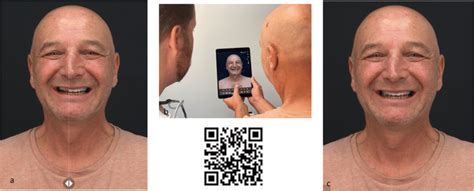 Co Diagnostic Session Using An Augmented Reality Protocol A Real Time Download Scientific