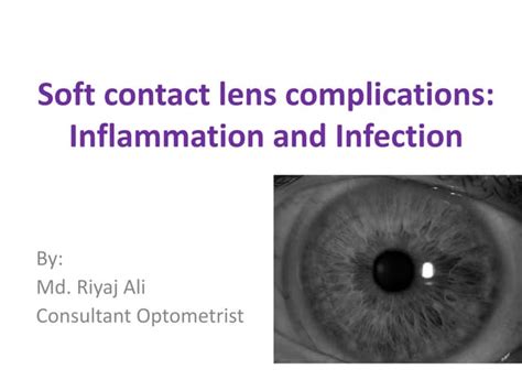 Soft Contact Lens Complications Pptx