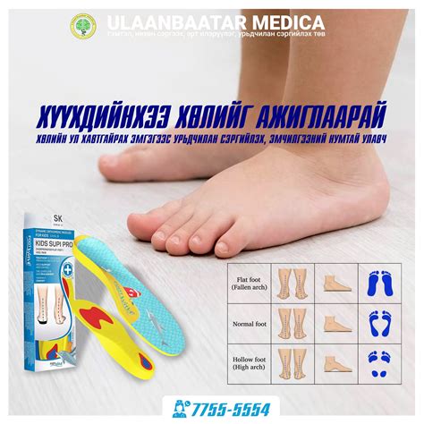 Улаанбаатар Медика Ulaanbaatar Medica гэмтэл нөхөн сэргээх эмнэлэг Хүүхдийн хөлийн ул