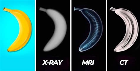 Ortho Globe X Ray Vs Ct Vs Mri Key Differences And Best Uses