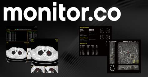 폐암·유방암 찾는 Ai 기술모니터코퍼레이션 70억 투자유치