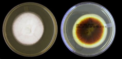 Fun With Microbiology Whats Buggin You Trichophyton Rubrum