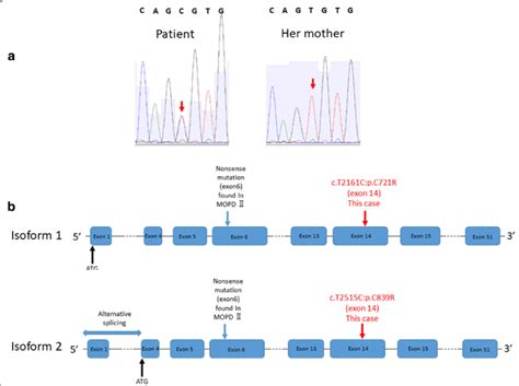 Missense Variant Present In Exon 14 The Variant Was Determined To Be Download Scientific