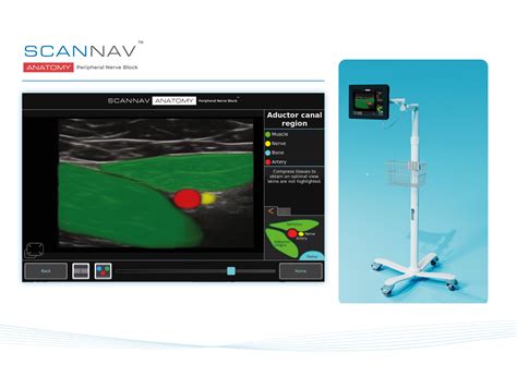Artificial Intelligence For Ultrasound Scanning In Regional Anaesthesia Esra
