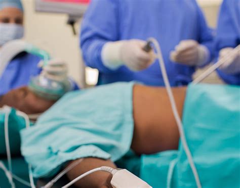 Laparoscopic Colostomy Candidates Procedure Recovery More