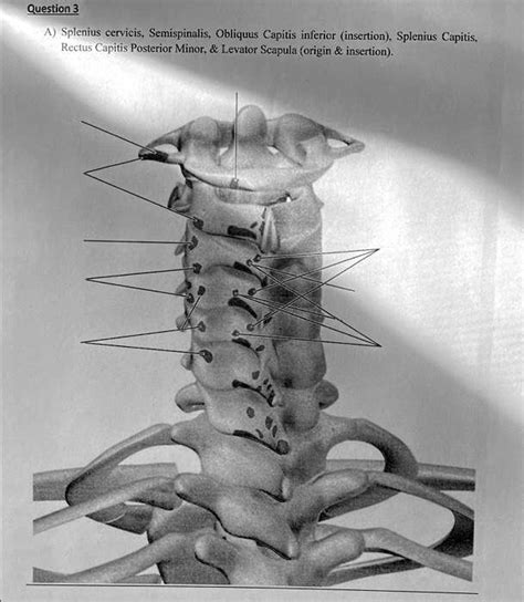 [get Answer] Question 3 A Splenius Cervicis Semispinalis Obliquus Capitis Inferior Insertion