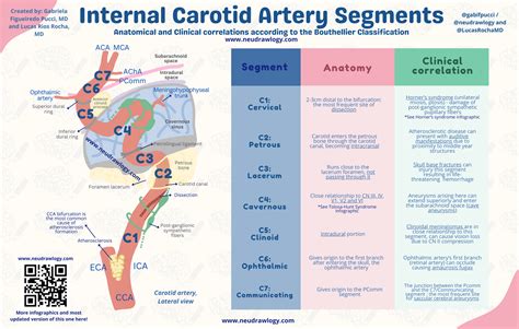 Vascular Neurology — Neudrawlogy Simplifying Neurology