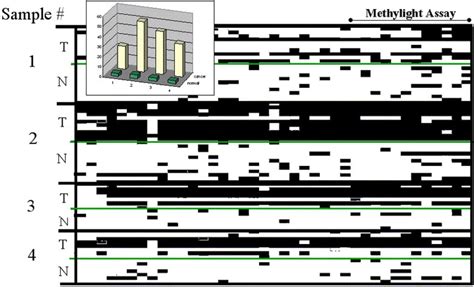 Aristaless Like Homeobox 4 Gene Methylation Is A Potential Marker For