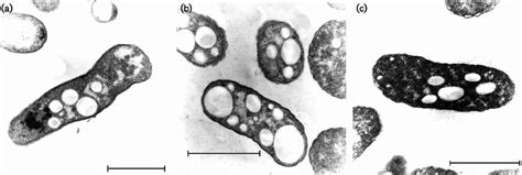 Transmission Electron Micrographs Of Cells Of Strains 15cr A R53 B Download Scientific