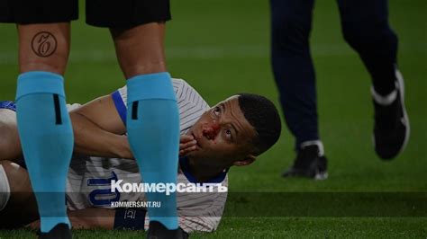 Киллиан Мбаппе получил травму носа во время матча Евро 2024
