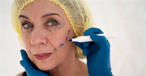 Customizing Your Botox Experience How To Get The Results You Want