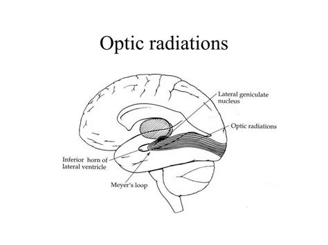 Optic Radiations Explained At Pamela Cerda Blog