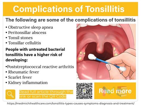 Complications Of Tonsillitis — More Than Just A Sore Throat Tonsillitis May Seem Like A Minor