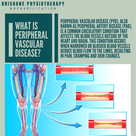 Peripheral Vascular Anatomy