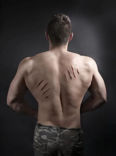 Scratch Marks Stock Photos Royalty Free Scratch Marks Images Depositphotos