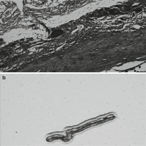 Arcturus Xt Infrared Laser Capture Microdissection Lcm Process A Download Scientific