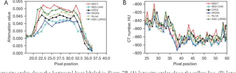 Figure 15 From Structure Preserving Low Dose Computed Tomography Image Denoising Using A Deep