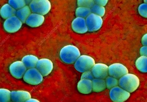 Staphylococcus Aureus Bacteria Stock Image B234 0072 Science