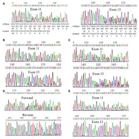 Mutation Analysis On The C Kit Gene For Surgical Melanoma Specimen