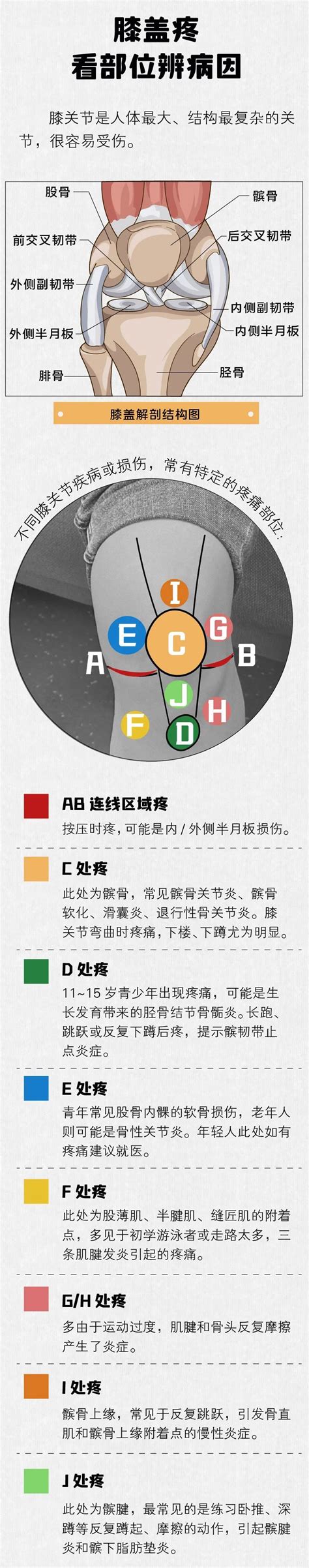一张膝盖疼痛位置对照表看清你的疼是什么病 腾讯新闻