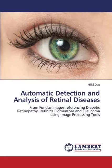 Automatic Detection And Analysis Of Retinal Diseases By Das Hillol English Pap Eur 57 25