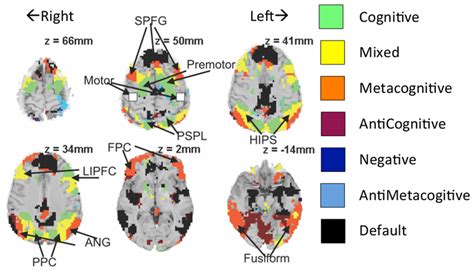 Classification Of Different Brain Regions In Terms Of Their Activation Download Scientific