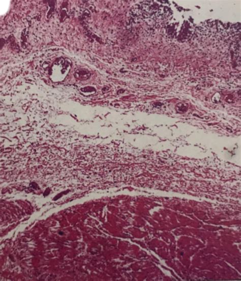 Bladder Wall Diagram Quizlet