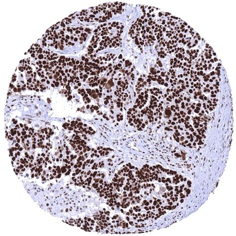 Cancer Tissue Gallery Gtx04416 Genetex