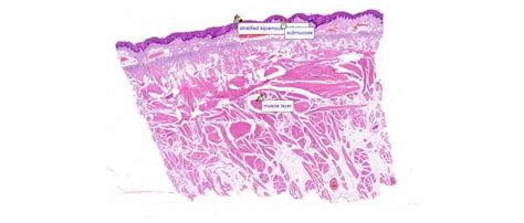 Oral Mucosa Oral Histology Digital Slides At ₹ 4720 Noida Id