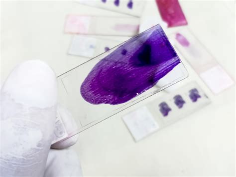 Standardizing Immunohistochemistry Staining Processes The Crucial Role Of Accreditation And Prs