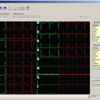 Programme Window Of The PC In House Software Download Scientific Diagram