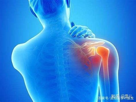 16岁肩膀疼痛是什么原因 知乎