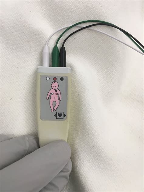 Pediatric Ecg Electrode Placement