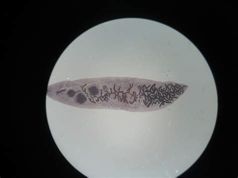 Ksmu Parasitology Class Trematoda