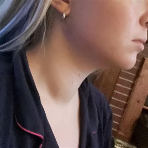 Thyroid Nodules And Goiter With All Clear Labsis There Any Way To Make