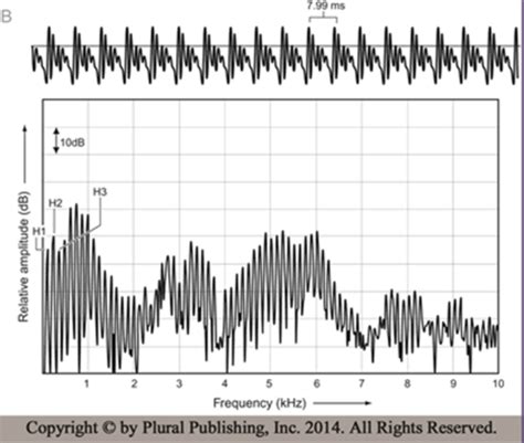 CSD 341 Exam 3 Flashcards Quizlet