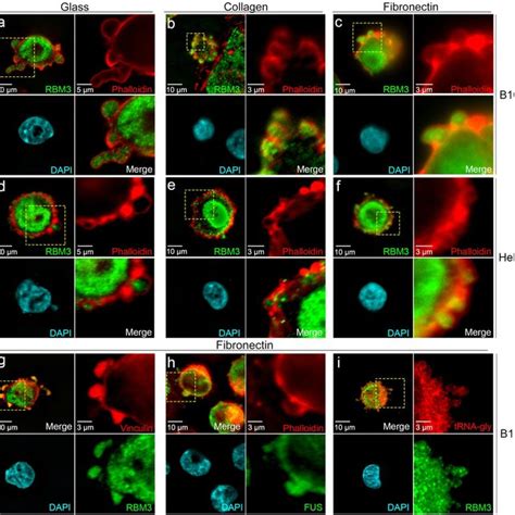 Localization Of Rbm3 To Sics In Different Cell Types And Plating