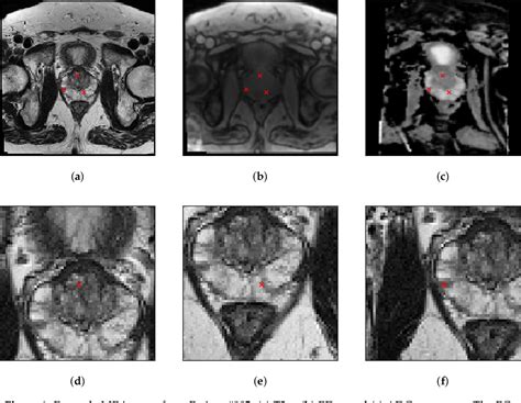 Figure 1 From A Hybrid End To End Approach Integrating Conditional Random Fields Into Cnns For