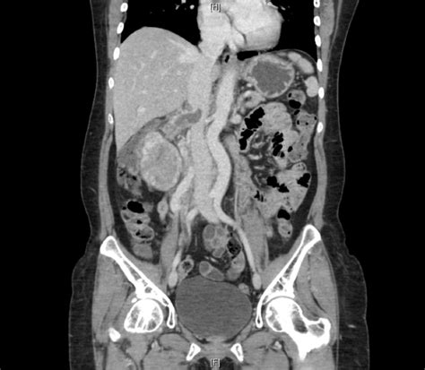Cross Sectional Computed Tomography Representative Imaging Of The Download Scientific Diagram