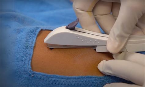 Implanon Klinik Uzma