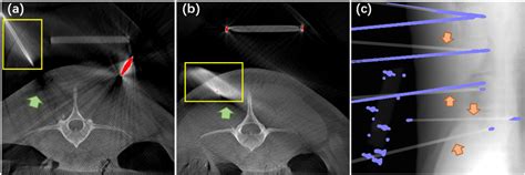 An Example From A Commercial Cbct System A And B Are Two Slices