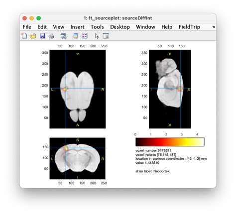 Channel And Source Analysis Of Mouse EEG FieldTrip Toolbox