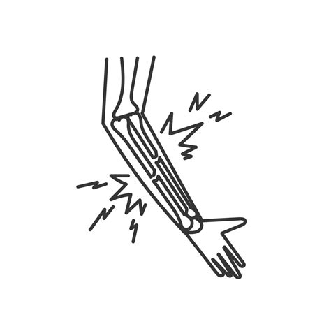 A Hand With A Bone Sticking Out Of It Fractured 50575461 Vector Art At Vecteezy