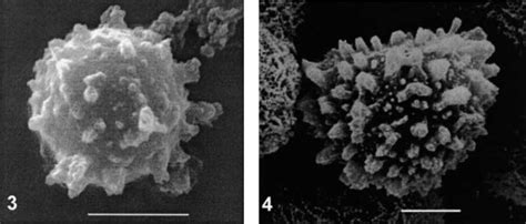 3 Pronounced Outwardly Extending Aggregates Result From The Use Of 2g Download Scientific