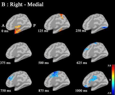statistical source maps of differences in t values p download