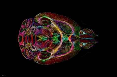 These Are The Most Detailed Scans Of A Mouse Brain Ever Taken Faculty Of Medicine